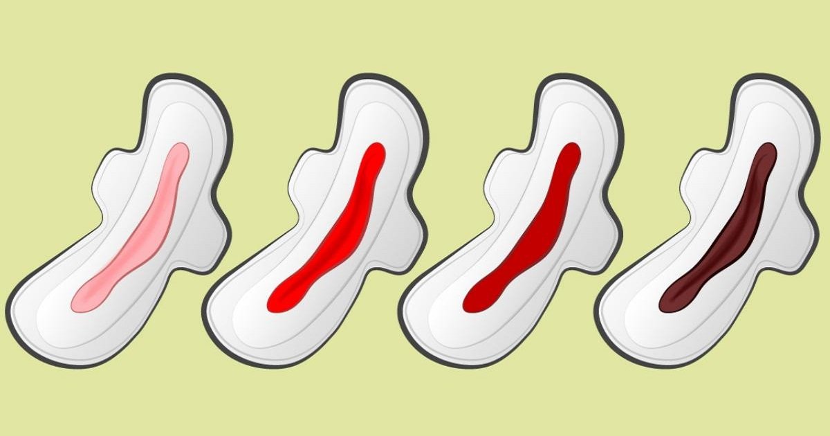 Why Is My Period Blood Brown? Causes and Solutions